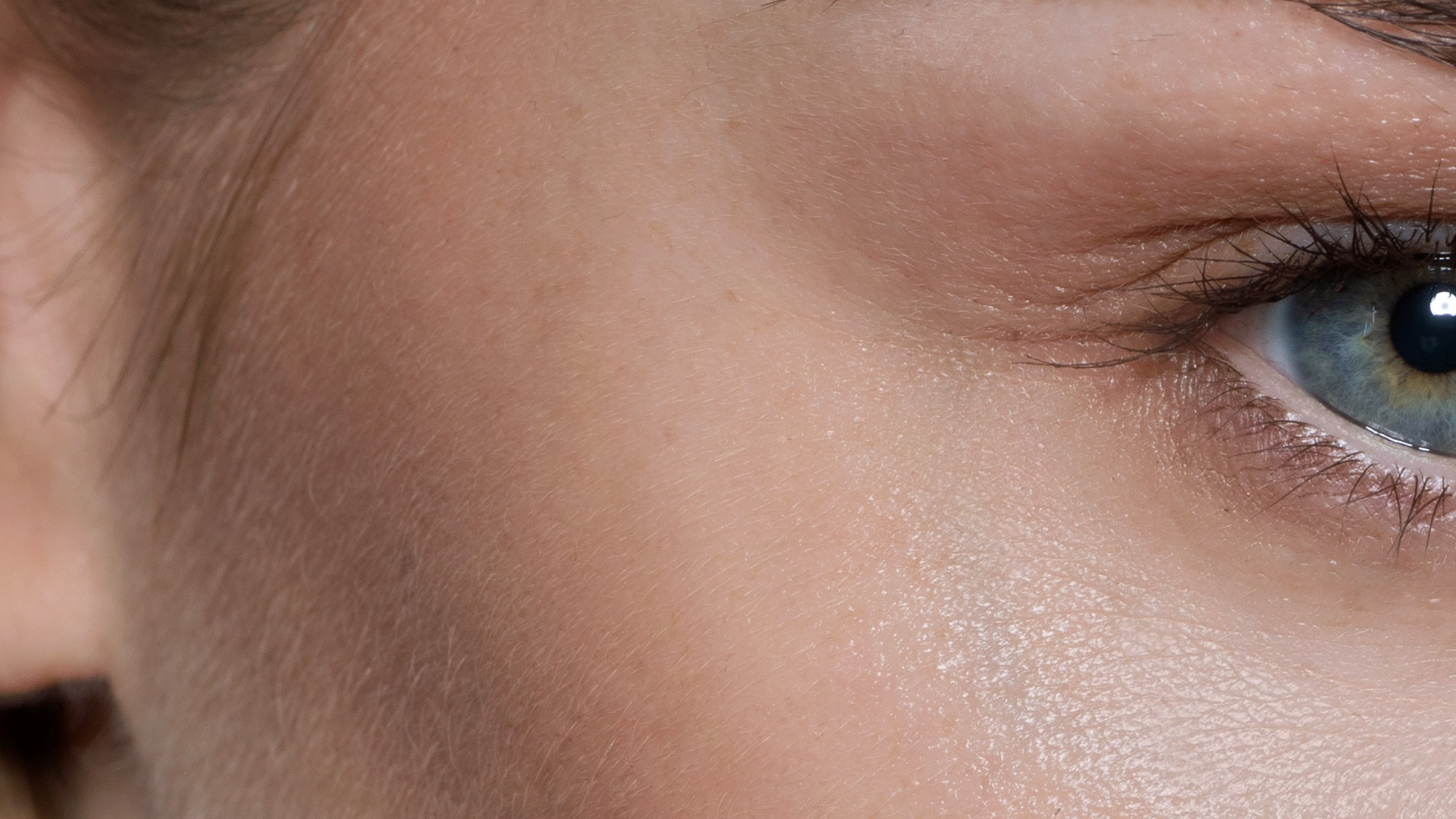 Cheekbones | IBSA Derma