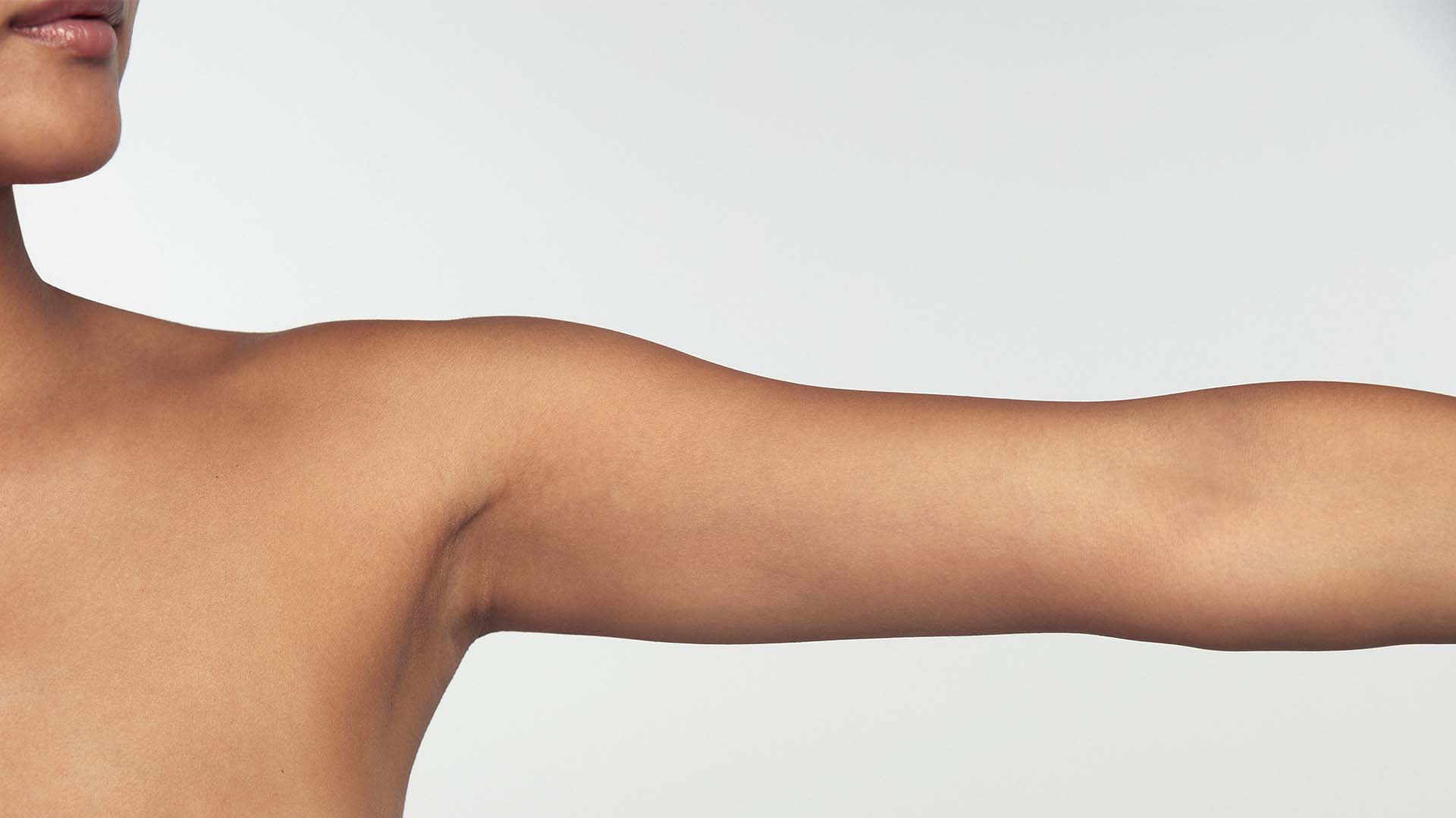 Correct the sagging skin on your arms | IBSA Derma